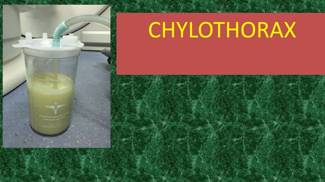 Chylothorax.pptx