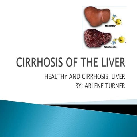Case presentation on Decompensated Chronic Liver Disease (Non Alcoholic ...