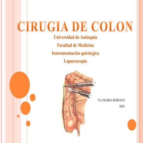 Cirugia de colon para instrumentadores via laparoscopica | PPTX