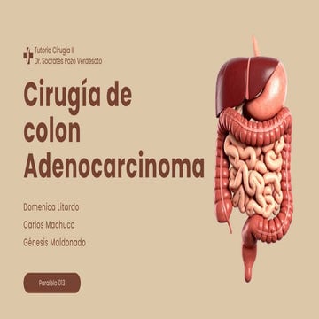 Cirugía de Colon, Generalidades y Adenocarcinoma | PDF