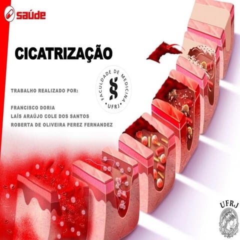 Cicatrização de Feridas em Cirurgia | PDF