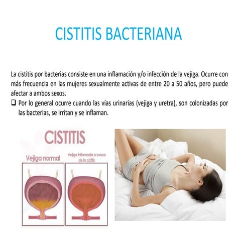 La cistitis