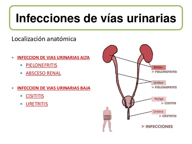 Cistitis y pielonefritis