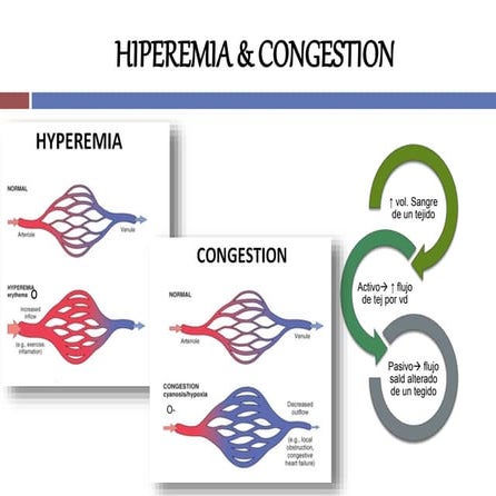 HIPEREMIA Y CONGESTIÓN TRANSTORNOS HEMODINAMICOS | PPTX