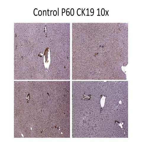 Ck19 slides 4 5 | PPTX