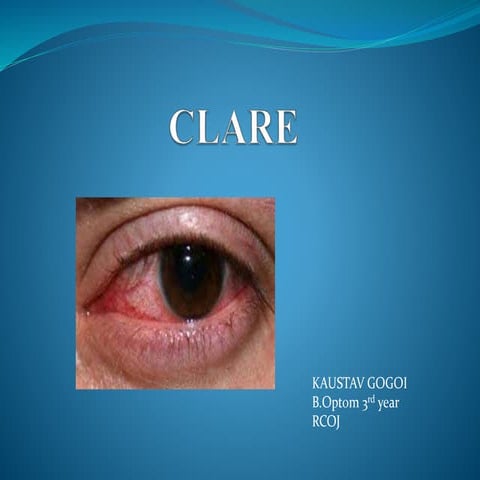 Clare Contact Lens Acute Red Eye Contact Lens Induced Acute Red