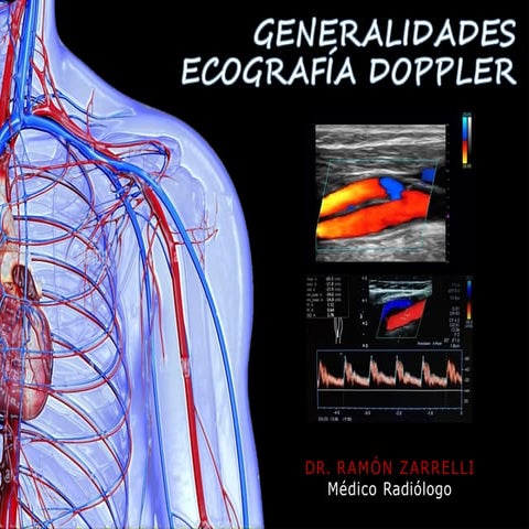 Problemas soluciones en Ecografia Doppler | PDF