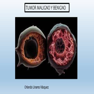CLASE 2 TUMOR MALIGNO Y BENIGNO.pptx introducción | PPTX