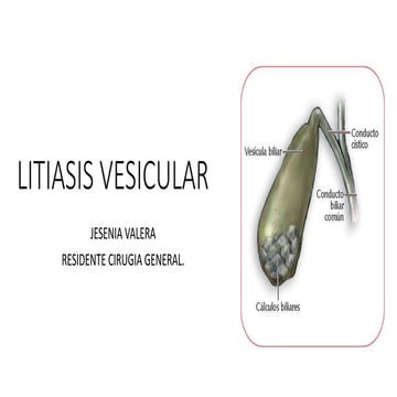 Litiasis biliar y colecistitis | PPT