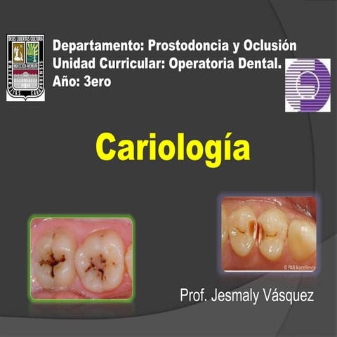 Clase de Cariología | PPTX