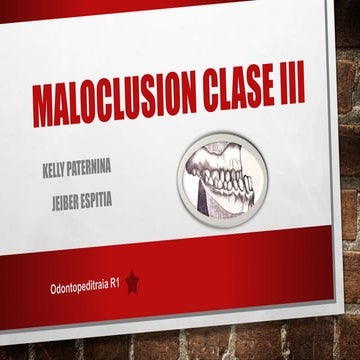 Maloclusión clase 3 dental y esqueletal en ortodoncia. | PPTX