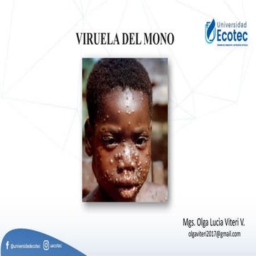 NORMA TECNICA DE SALUD DE VIRUELA DEL MONO.pptx