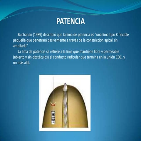 Instrumentacion (endodoncia) | PPTX