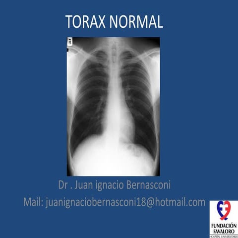 Clase torax normal - Diagnostico por Imagenes - Barcelo | PDF