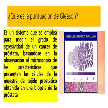 clasificación gleason.pptx