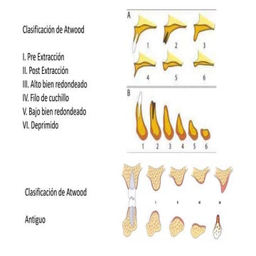 clasificacion reabsorcion osea.pptx