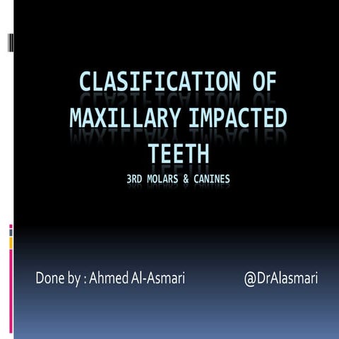 Clasification of ma xillary impacted teeth | PPTX