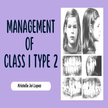 Managemnt of Class 1 Type-2-Malocclusion.pdf