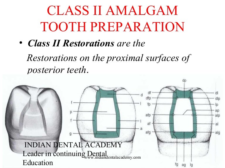 Tooth Preparation Dental Implant Courses