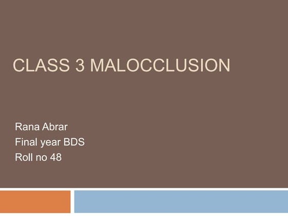 Class III Malocclusion | PPTX