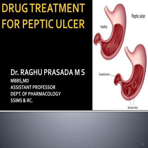Peptic Ulcer Treatment Review Of Peptic Ulcer Disease – Pharmacology
