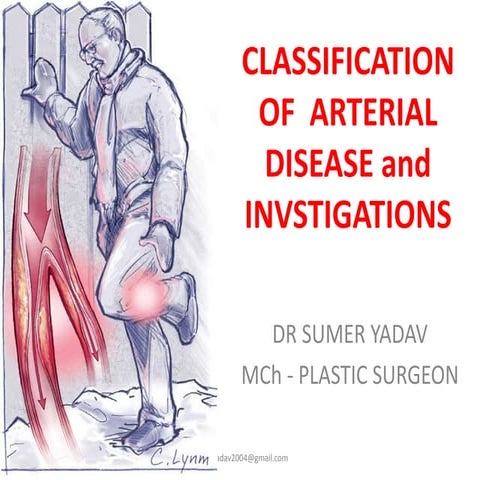 Classification of arterial disease and invstigations | PPTX
