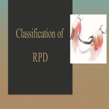 Kennedy’s Classification in Cast Partial Denture | PPTX