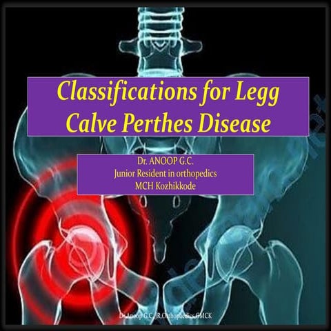Classification perthes Disease | PDF