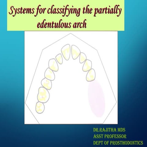 Classification System for The Partially Edentulous Arches (1).ppt
