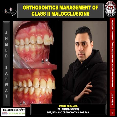 Orthodontic Management of Class ll malocclusion by Ahmed Safwat | PPTX