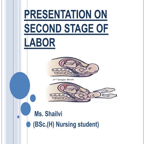 presentation on second stage of labor | PPTX