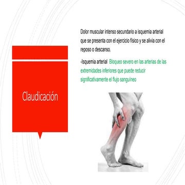 Claudicación (1).pptx