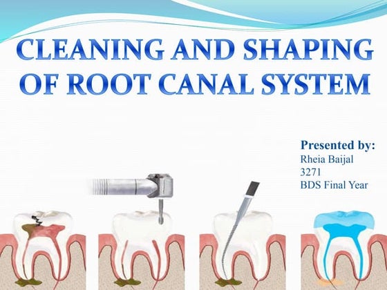 Root canal preparation techniques _ endodontic treatment | PPTX | Oral care | Personal Care