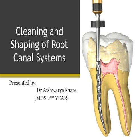 CLEANING N SHAPING methods advantages and disadvantages | PPTX