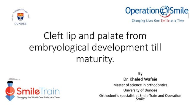 Natal and neonatal teeth | PPTX