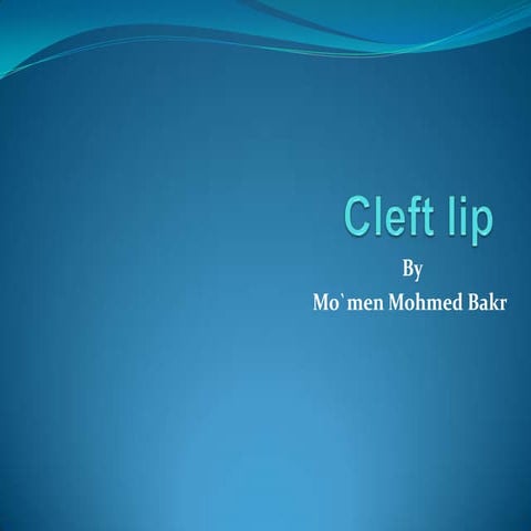 Cleft lip and palate | PPTX