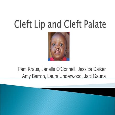 Cleft lip | PPT