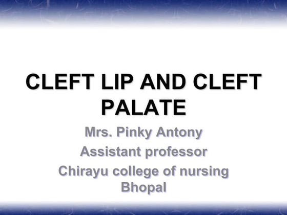 Cleft lip and cleft palate | PPTX