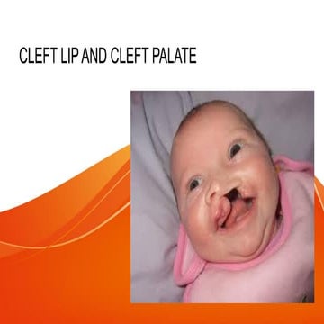 Cleft Lip and Cleft Palate congenital abnormalities of lip and palate | PDF