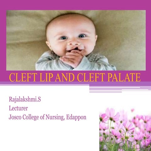 CLEFT LIP AND PALATE: NURSING MANAGEMENT.pptx
