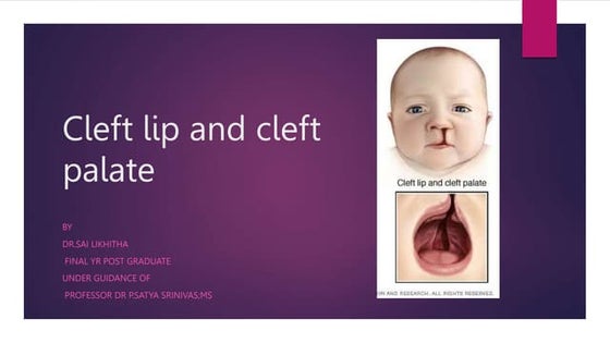 ptat 1 facial palsy 2021.pptxFacial palsy general ENT course for first ...