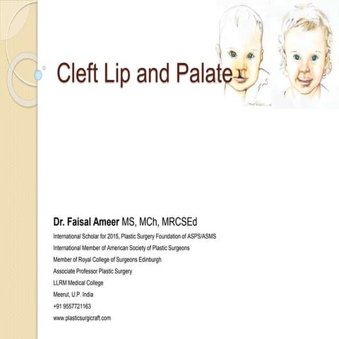 Cleft lip and palate basics | PPTX