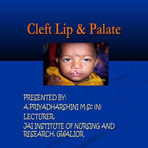 Cleft lip __palate | PPT