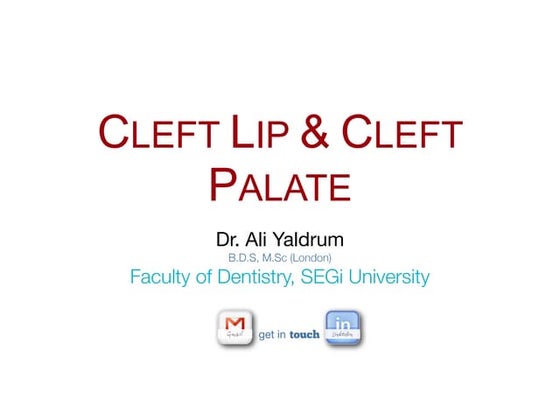 Cleft lip and cleft palate | PPTX
