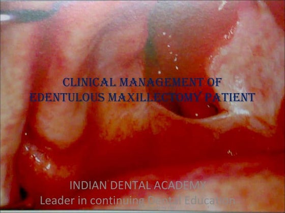Dental implant surgery | PDF