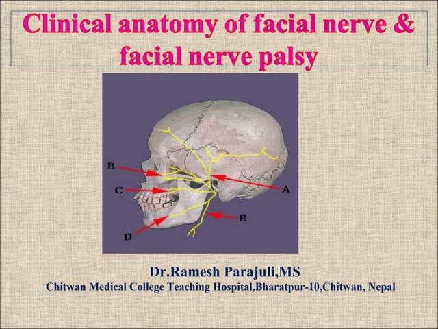 Facial Nerve Palsy | PPTX