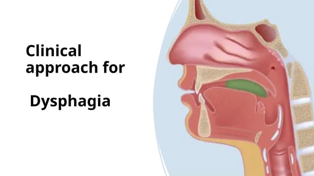 Dysphagia | PPT