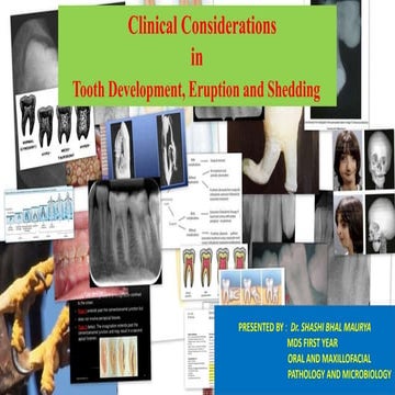 Clinical consideration in tooth development, eruption and shedding | PPTX
