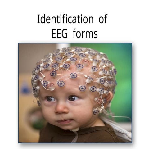 clinical interpretation of eeg and disease based interpretation .pptx