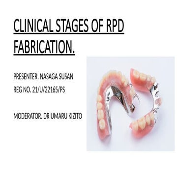CLINICAL STAGES OF FABRICATION of Removable partial dentures | PPTX